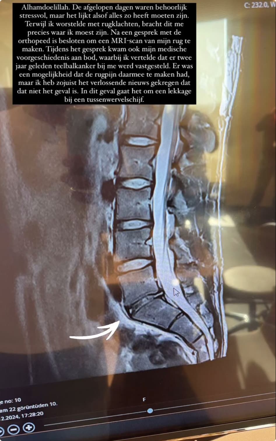 Spannende medische uitslag voor Donny Roelvink | Shownieuws