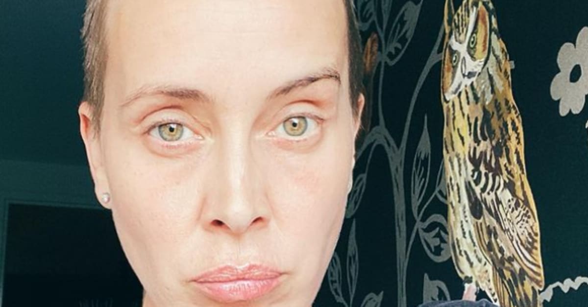 'Kale' look Anouk zorgt voor discussie | Shownieuws