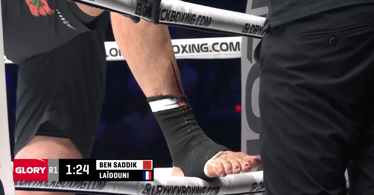 Jamal Ben Saddik verliest vanwege grote snee in been