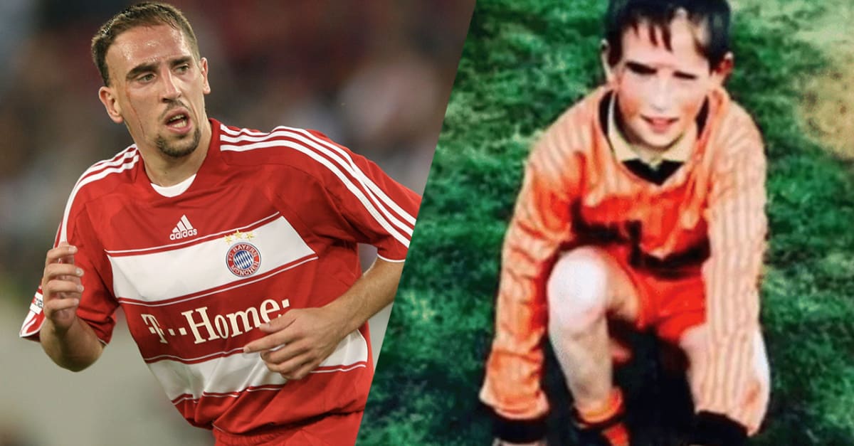 Dit is het dramatische verhaal achter de littekens van Franck Ribéry ...