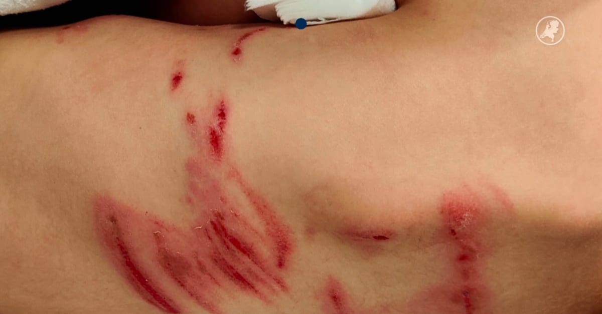 'Kind gebeten en meegesleurd door wolf in bos bij Austerlitz'