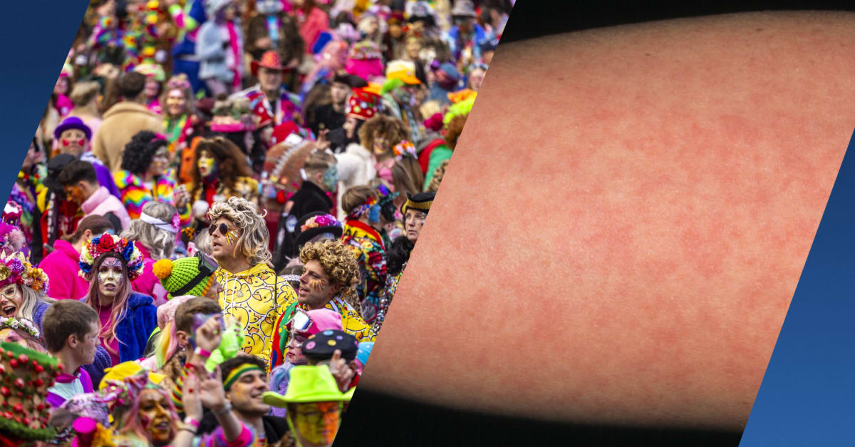 Mazelenuitbraak vlak voor carnaval: 'Blijf thuis als je je niet lekker ...