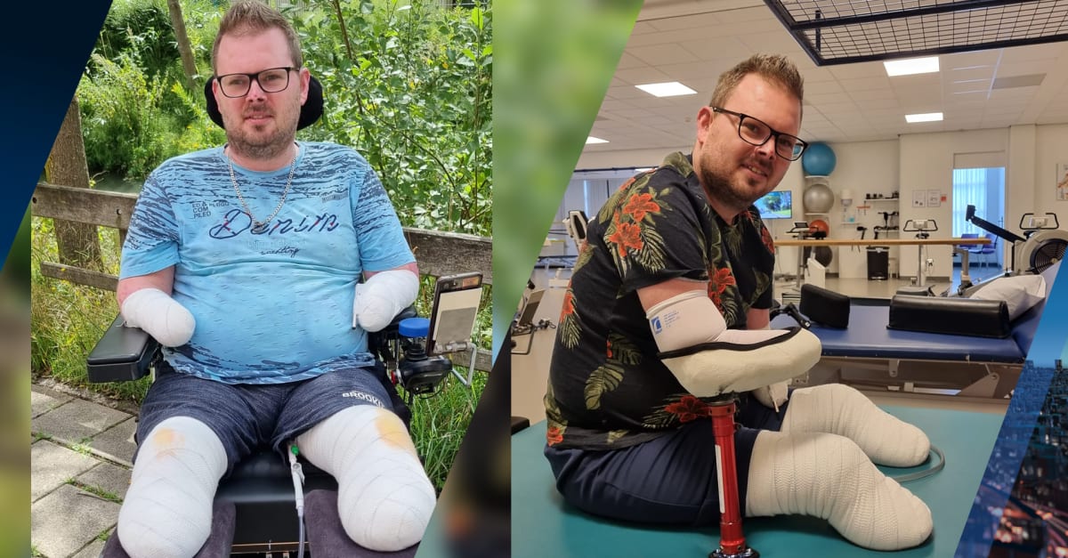 Al 150.000 euro opgehaald bij crowdfundingsactie voor Kees (34) die na ...