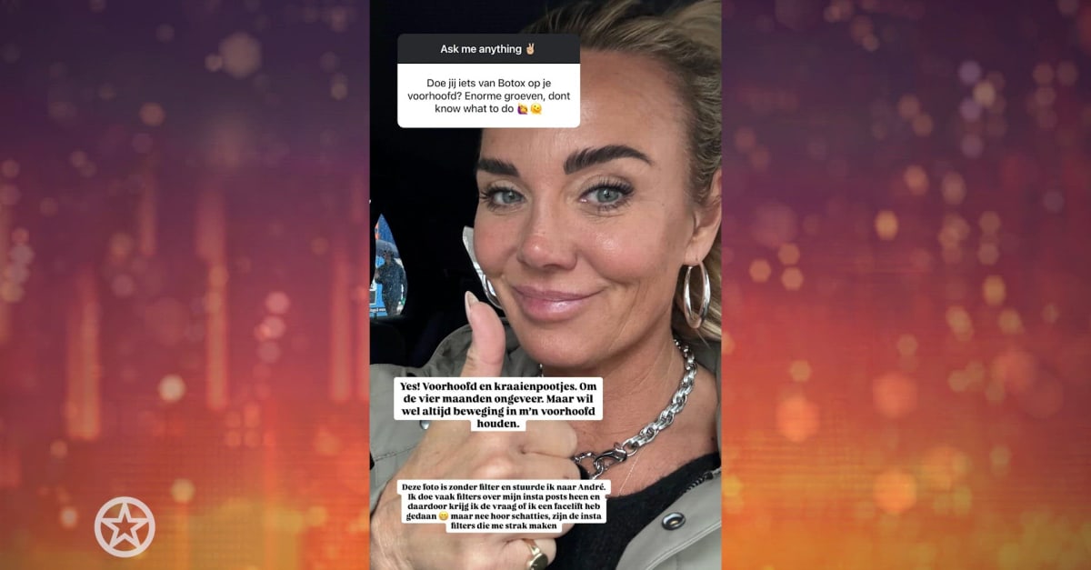 Shownieuws: Voor en na foto's neus Monique Westenberg