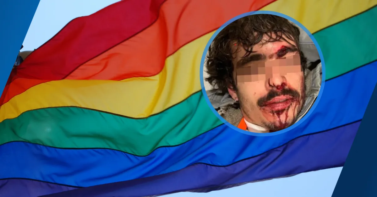 Band aangevallen bij queer space Venlo, zoon Sunny Bergman bewusteloos ...