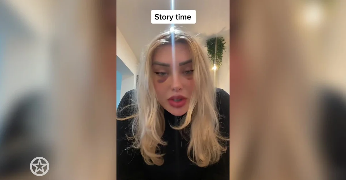 Shownieuws: Brits OnlyFans-model op TikTok over 'ontploft' hoofd in ...